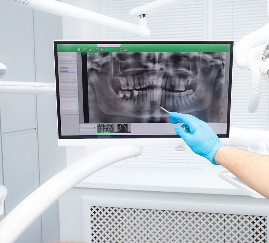 Surgical Orthodontics | Level Orthodontics Ellicott City MD